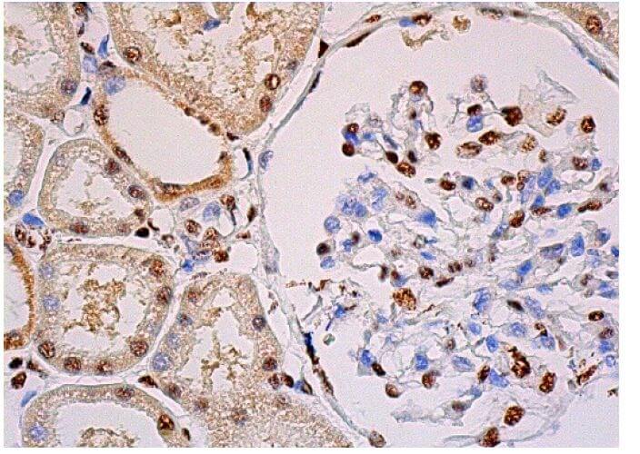 P Tau Antibody Phf 6 Santa Cruz Biotech