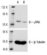 γPAK shRNA Plasmid (m)