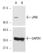γPAK shRNA Plasmid (h)