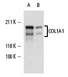 COL1A1 Antibody (D-13) | Santa Cruz Biotech