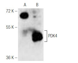 PDK4 Antibody (P-24) | Santa Cruz Biotech