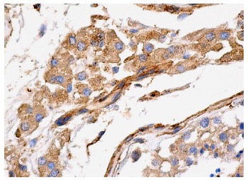 spectrin α II Antibody (C-11) | Santa Cruz Biotech
