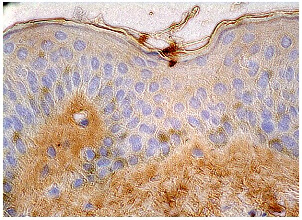 Fibronectin Antibody (P1H11) | Santa Cruz Biotech
