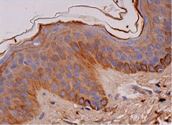 Fibronectin Antibody (IST-1) | Santa Cruz Biotech