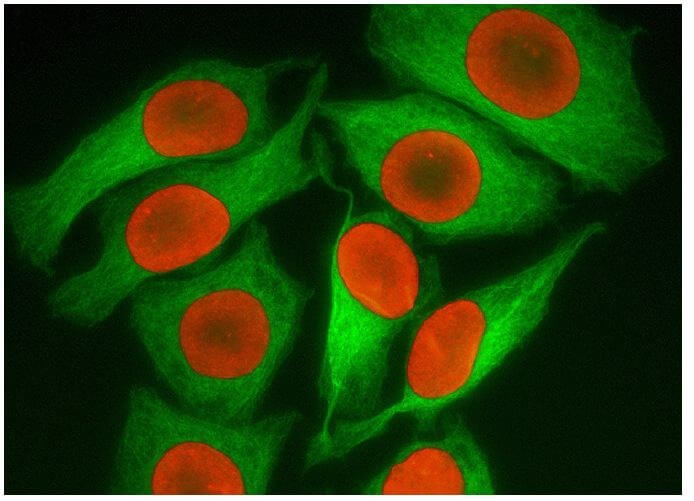 Lamin A/C Antibody (636) | Santa Cruz Biotech