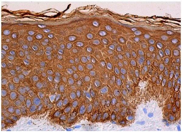 pan-Cytokeratin Antibody (AE1/AE3) | Santa Cruz Biotech
