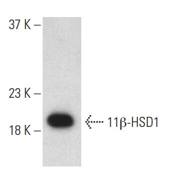 Anti-11β-HSD1 Antibody (D-5) | SCBT - Santa Cruz Biotechnology