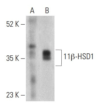 Anti-11β-HSD1 Antibody (D-5) | SCBT - Santa Cruz Biotechnology