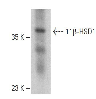 Anti-11β-HSD1 Antibody (D-5) | SCBT - Santa Cruz Biotechnology