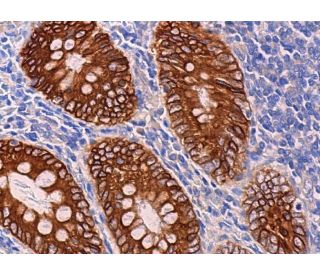 11β-HSD2 Antibody (C-9) - Immunohistochemistry - Image 371454