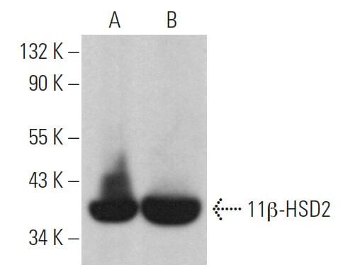 11β-HSD2 Antibody (C-9) | SCBT - Santa Cruz Biotechnology