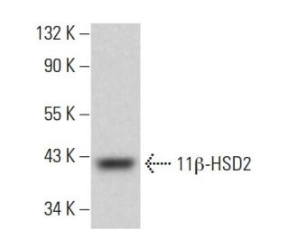 11β-HSD2 Antibody (C-9) - Western Blotting - Image 381086