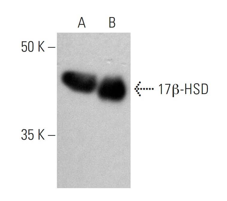 17β-HSD Antibody (A-5) | SCBT - Santa Cruz Biotechnology