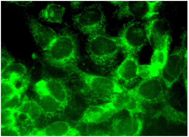 Anti-17β-HSD Antibody (D-8) | SCBT - Santa Cruz Biotechnology