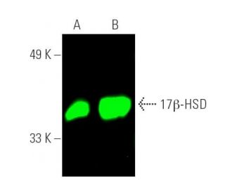 17β-HSD Antibody (D-8) - Western Blotting - Image 389949