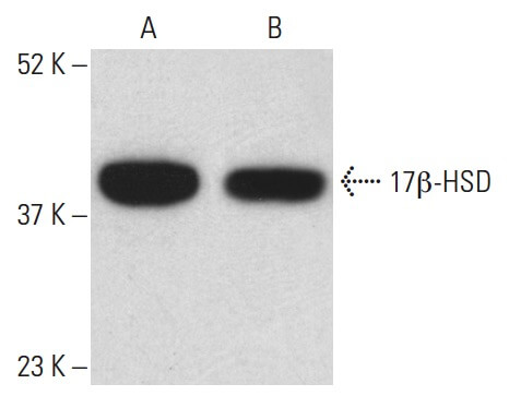 17β-HSD Antibody (D-8) | SCBT - Santa Cruz Biotechnology