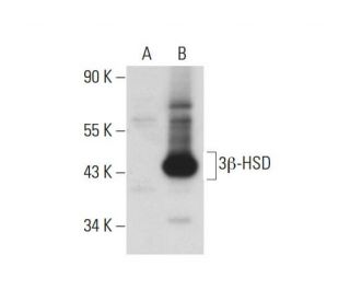 3β-HSD Antibody (37-2) - Western Blotting - Image 127042