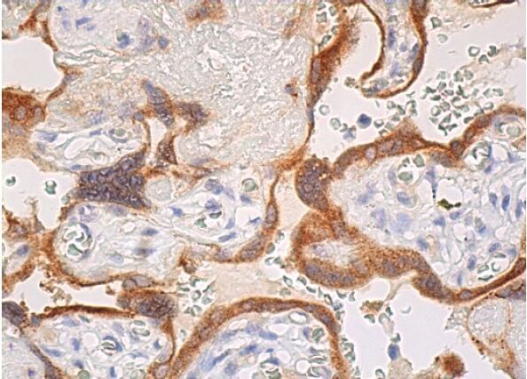 3β-HSD Antibody (A-1) | SCBT - Santa Cruz Biotechnology
