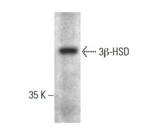 3β-HSD Antibody (A-1) - Western Blotting - Image 385741
