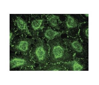 Anti-4.1N Antibody (B-2) | SCBT - Santa Cruz Biotechnology