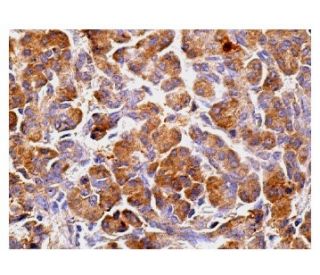 4E-BP1 Antibody (P-1) - Immunohistochemistry - Image 156691