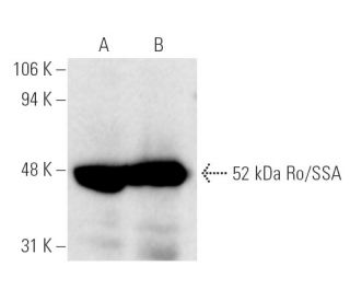Anti-52 kDa Ro/SSA Antibody (D-12) | SCBT - Santa Cruz Biotechnology