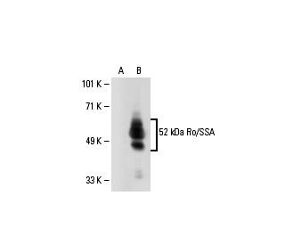 52 kDa Ro/SSA Antibody (D-12) - Western Blotting - Image 20714