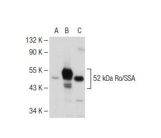 Anti-52 kDa Ro/SSA Antibody (D-12) | SCBT - Santa Cruz Biotechnology