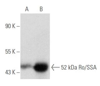 52 kDa Ro/SSA Antibody (D-12) - Western Blotting - Image 354717
