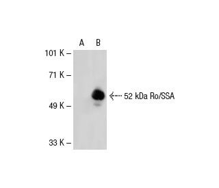 52 kDa Ro/SSA Antibody (E-11) - Western Blotting - Image 20716