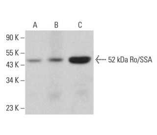 52 kDa Ro/SSA Antibody (E-11) - Western Blotting - Image 380306