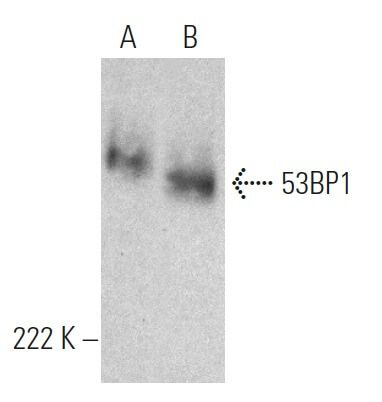 53BP1 Antibody (E-10) | SCBT - Santa Cruz Biotechnology