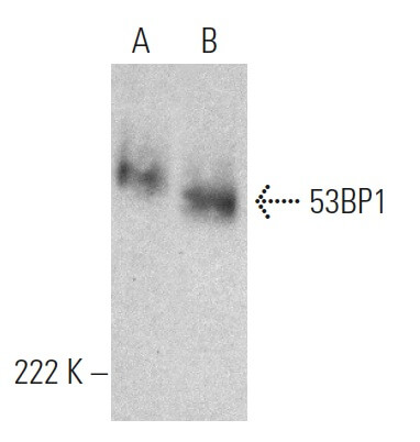 Anti-53BP1 Antibody (E-10) | SCBT - Santa Cruz Biotechnology