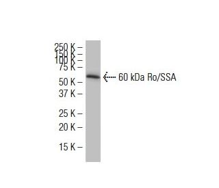 60 kDa Ro/SSA Antibody (AA-3) - Western Blotting - Image 34216