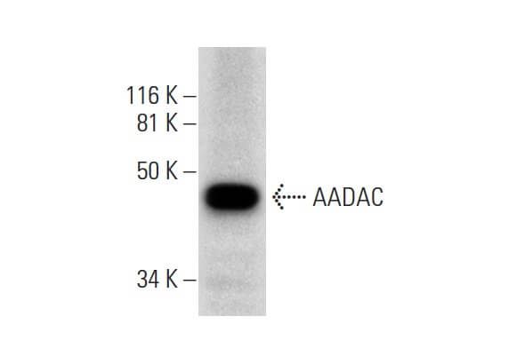 AADAC Antibody (H-8) | SCBT - Santa Cruz Biotechnology