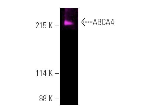 Anti-ABCA4 Antibody (3F4) | SCBT - Santa Cruz Biotechnology