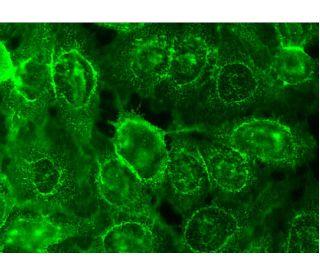 ABCG2 Antibody (BXP-21) | SCBT - Santa Cruz Biotechnology