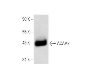 ACAA2 Antibody (192) - Western Blotting - Image 70374