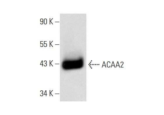 ACAA2 Antibody (192) | SCBT - Santa Cruz Biotechnology