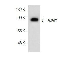 ACAP1 Antibody (B-11) | SCBT - Santa Cruz Biotechnology