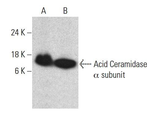 Anti-Acid Ceramidase Antibody (23) | SCBT - Santa Cruz Biotechnology