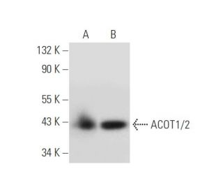 ACOT1/2 Antibody (F-2) | SCBT - Santa Cruz Biotechnology
