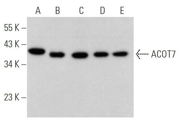 ACOT7 Antibody (B-4) | SCBT - Santa Cruz Biotechnology