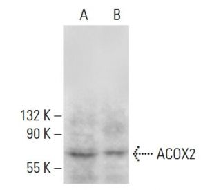 ACOX2 Antibody (A-7) | SCBT - Santa Cruz Biotechnology