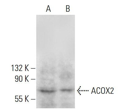 ACOX2 Antibody (A-7) | SCBT - Santa Cruz Biotechnology