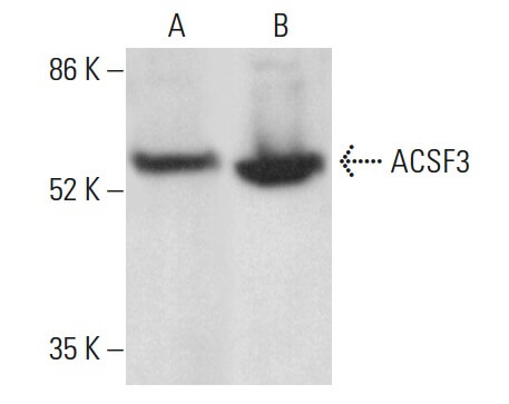 Anti-ACSF3 Antibody (F-5) | SCBT - Santa Cruz Biotechnology