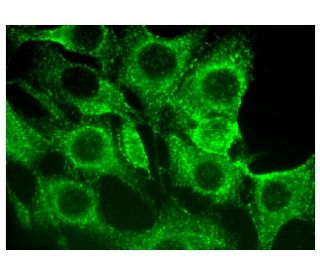ACSM3 Antibody (G-8) - Immunofluorescence - Image 282730