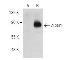 ACSS1 Antibody (A-10) | SCBT - Santa Cruz Biotechnology