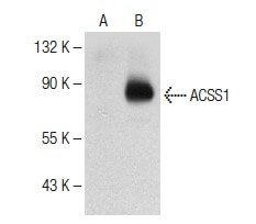 Anti-ACSS1 Antibody (A-10) | SCBT - Santa Cruz Biotechnology
