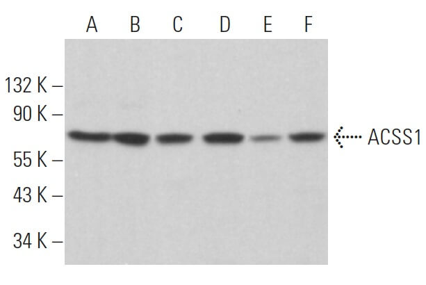 Anti-ACSS1 Antibody (A-10) | SCBT - Santa Cruz Biotechnology